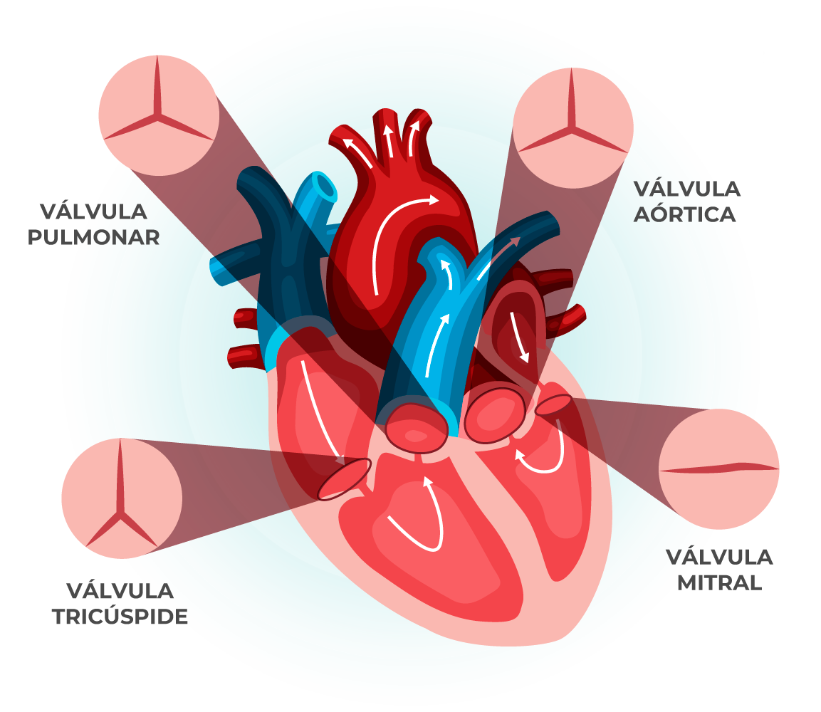 Valvulopatías – PACO